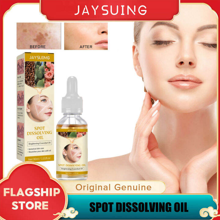 Jaysuing Spot Dissolving Oil Natural Removal Freckle Moisturizer Whitening Serum Face Spots ...