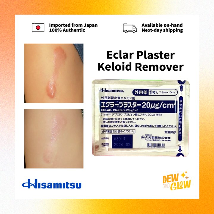 Hisamitsu Eclar Plaster Keloid Scar Remover | Lazada PH