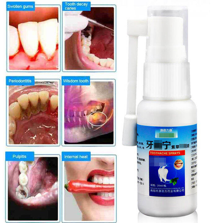 Toothache Pain Relief Teeth Care Sprays Effective Dental Tooth Pain ...