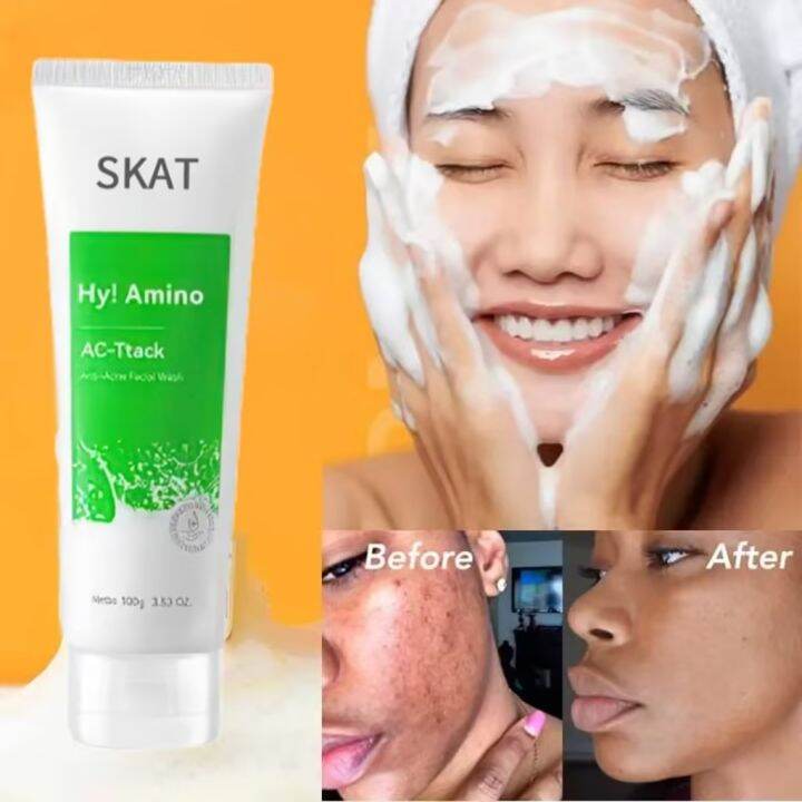 SKAT Salicylic Acid Anti-Acne Facial Wash Cleanser 100g For Daily ...