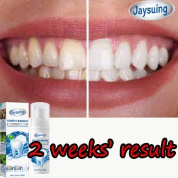 【Ship From Manila】Fresh Shiny Tooth-Cleaning Mousse Toothpaste Teeth ...