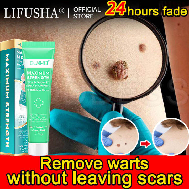 【Fast+Painless】ELAIMEI Warts remover original Skin tags remover ...