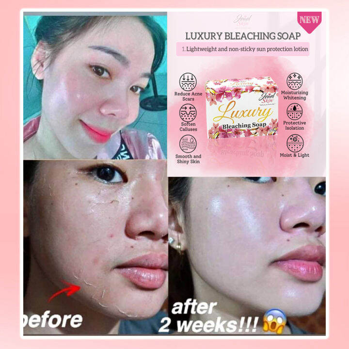 Jewel Skin Luxury Bleaching Soap | Ultra Bleaching Intensive Skin ...