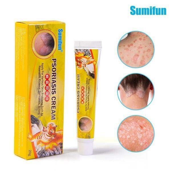 3PCS Sumifun Psoriasis Cream Bacteriostasis Eczema Dermatitis Anti ...