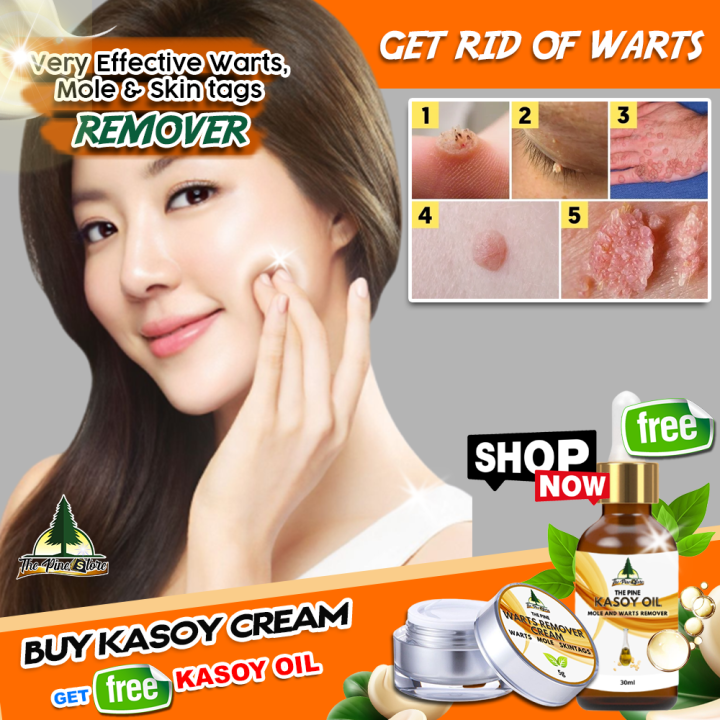 Best Seller Kasoy Cream 5g Free Kasoy Oil 30ml 100% Very Effective for ...