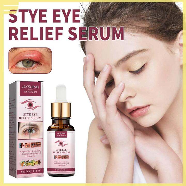 Stye eye relief irritation, blepharitis, redness and swelling, serum ...