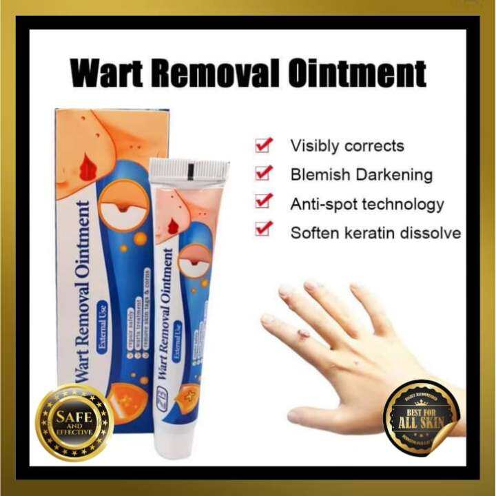 ORIGINAL Wart Removal Ointment Wart Treatment Cream Neck Skin Tag ...