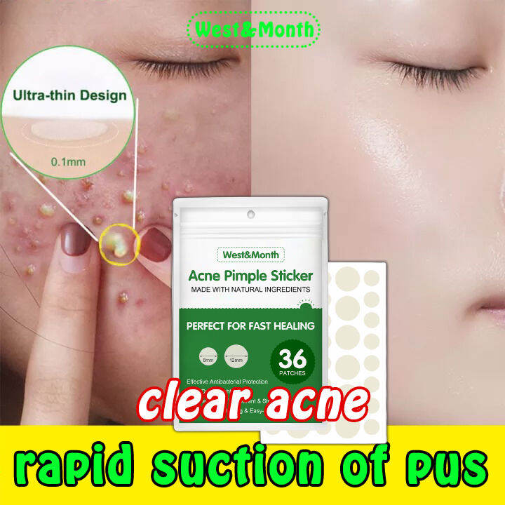 ELAIMEI Acne Pimple Patch *Salicylic acid soothes and repairs acne ...