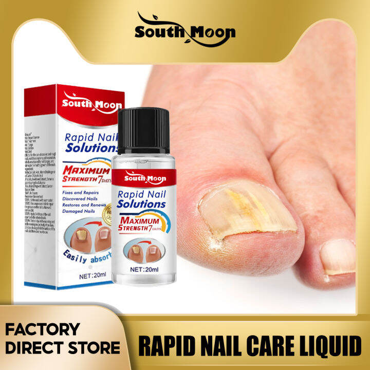 South Moon Rapid Nail Care Liquid Nail Care Liquid Anti Infection ...