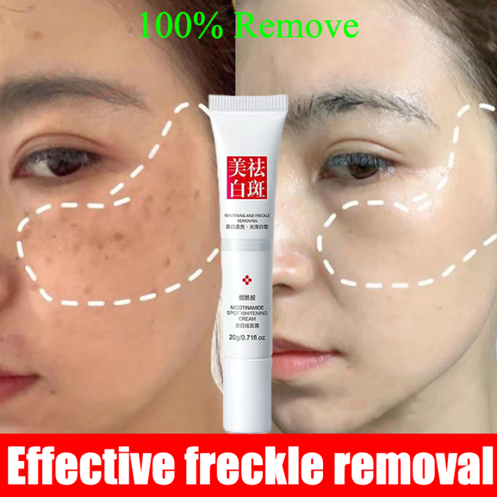 retinol serum for face serum vitamin c & collagen Effective freckle removal whitening cream anti ...