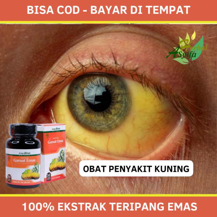 Obat Penyakit Kuning, Obat Penyakit Mata Kuning, Obat Untuk Sakit ...