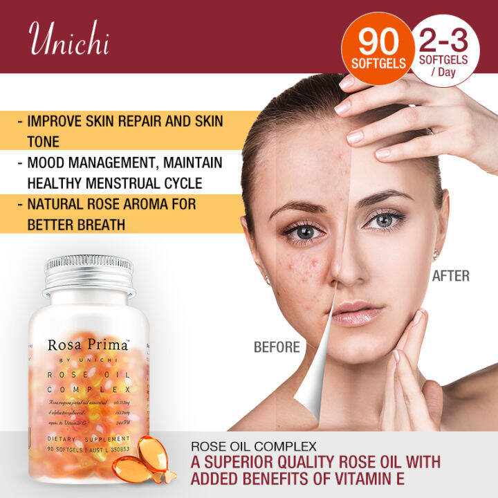 Unichi Rosa Prima Rose Essential Oil Complex Brighten Skin Fight Acne ...