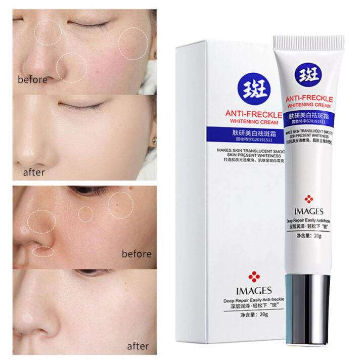 Dark Spot Corrector Cream Whitening Freckle Cream Powerful Removing Melasma Melanin Dark Spots ...