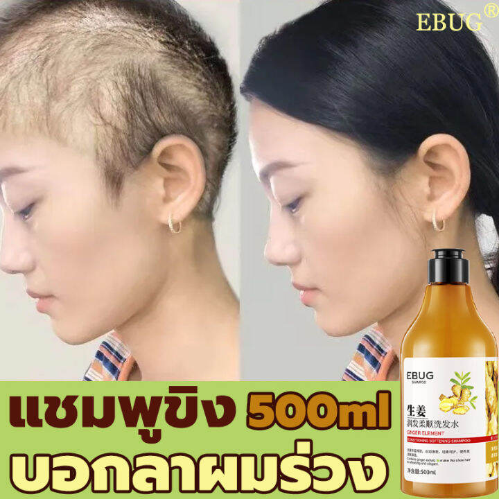 สูตรสมุนไพร EBUG 500ML แชมพูปลูกผม ยาสระผมแก้ร่วง บำรุงรากผม ป้องกันผม ...