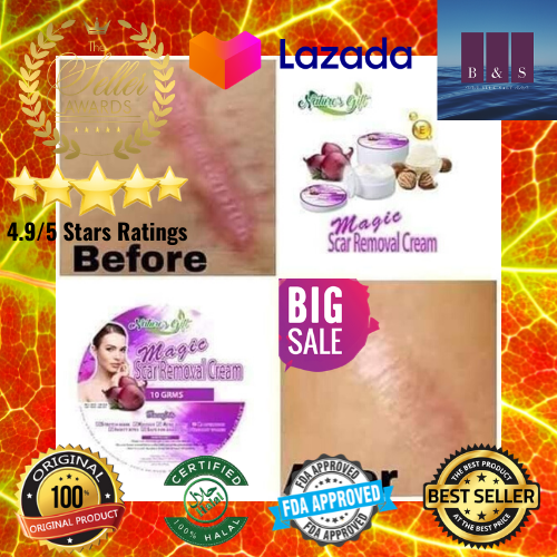 [Ready Stock] Charlie. New Authentic original Magic Scar Removal ...