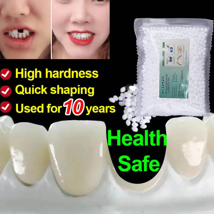 【Fast filling】DIY Tooth Repair Kit Temporary Tooth Repair kit ...