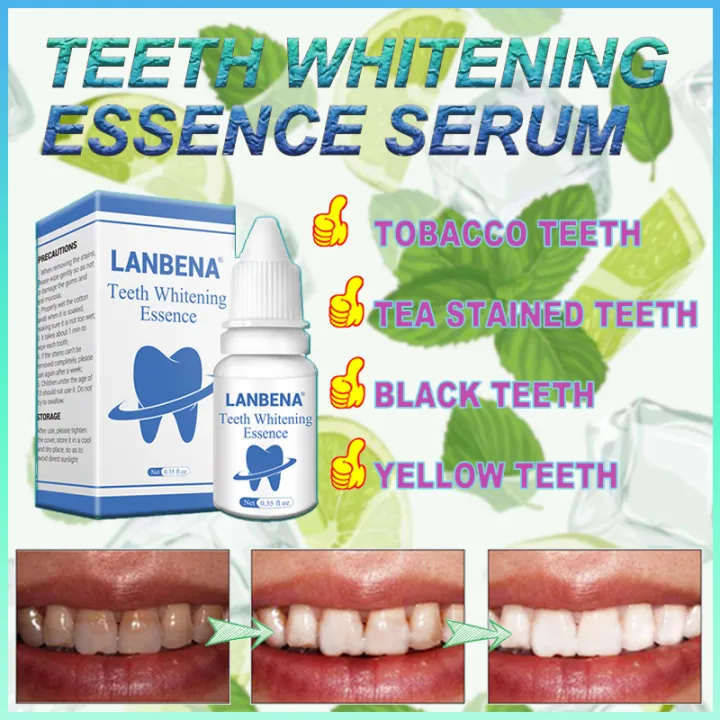 💕Fast Delivery&COD💕Teeth Whitening Essence Serum Plaque Stains Tooth ...