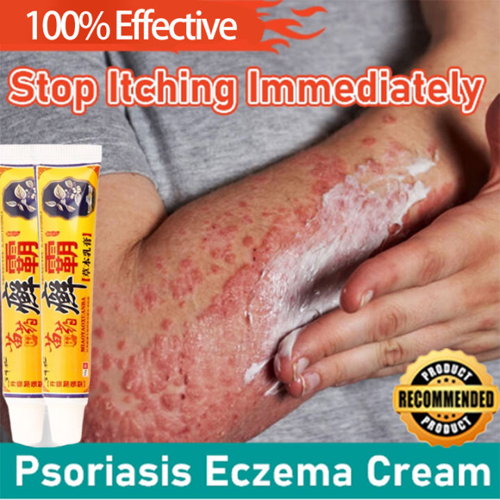 Herbal Ointments For Skin Deases Eczema Treatment Cream Anti Fungal
