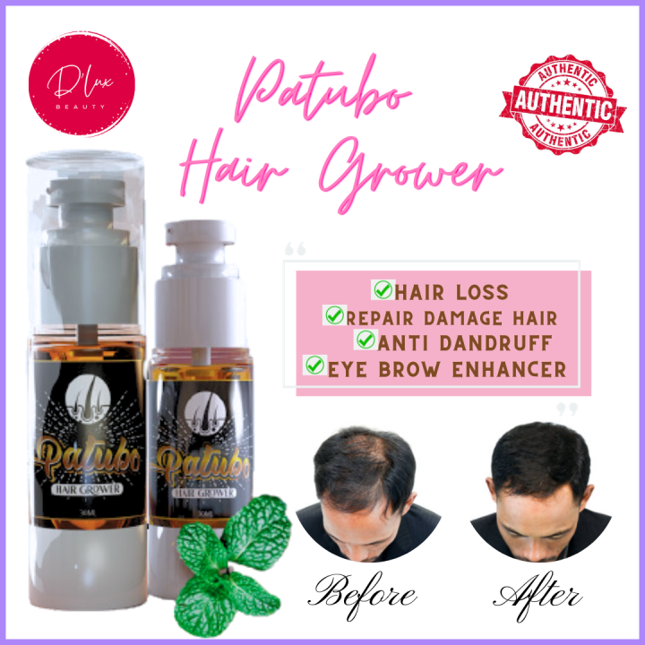 Patubo Hair Grower Hair Treatment Minoxidil Hair Growth Serum 10x Faster Anti Hair Loss Hair ...