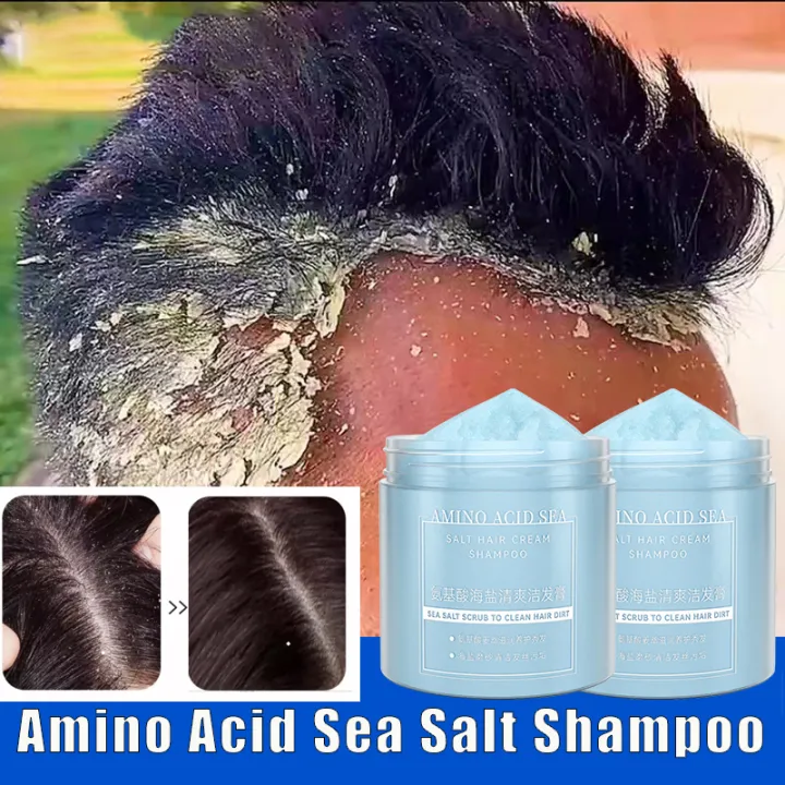 250ml CCA Sea Salt Shampoo Anti-Dandruff Refreshing Oil Control Deep ...