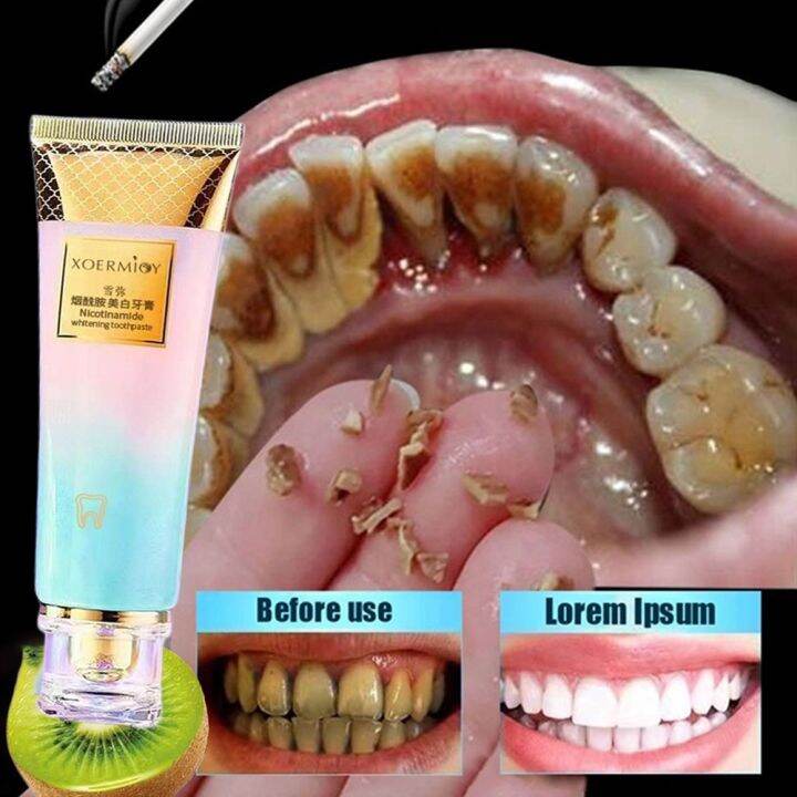 nicotinamide bodyaid toothpaste remove tartar removal remover teeth ...