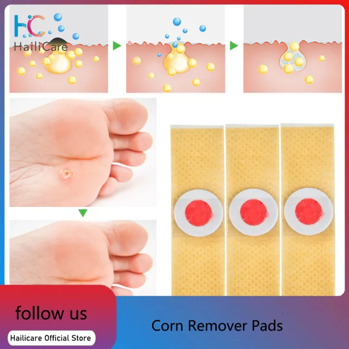 Hailicare Corn Remover Pads Foot Care Stickers Toe Corn and Callus ...