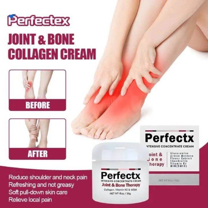 【24H Fast】PERFECTX urate therapy cream, joint and bone therapy cream ...