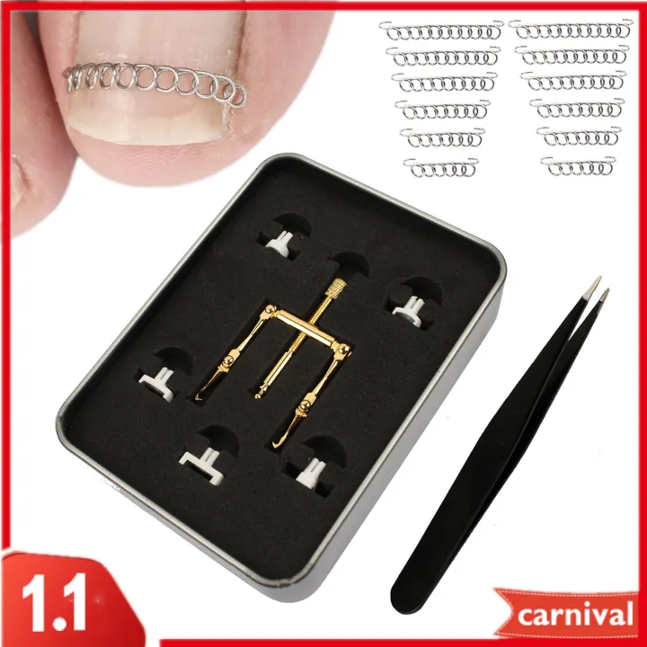 Moon Lighte Ingrown Toenail Correction Nail Lifter Clamp File Toe ...