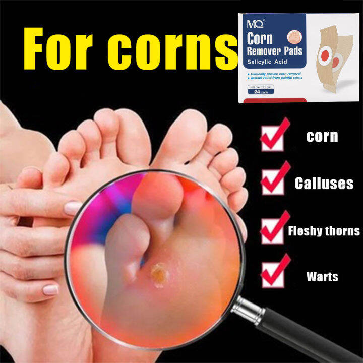 Foot Corn Removal Plaster Warts Thorn Patch Feet Warts Removal Patch ...