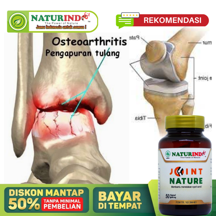Obat Radang Sendi Paling Ampuh, Nyeri Sendi, Lutut Bengkak Dan Kaku ...