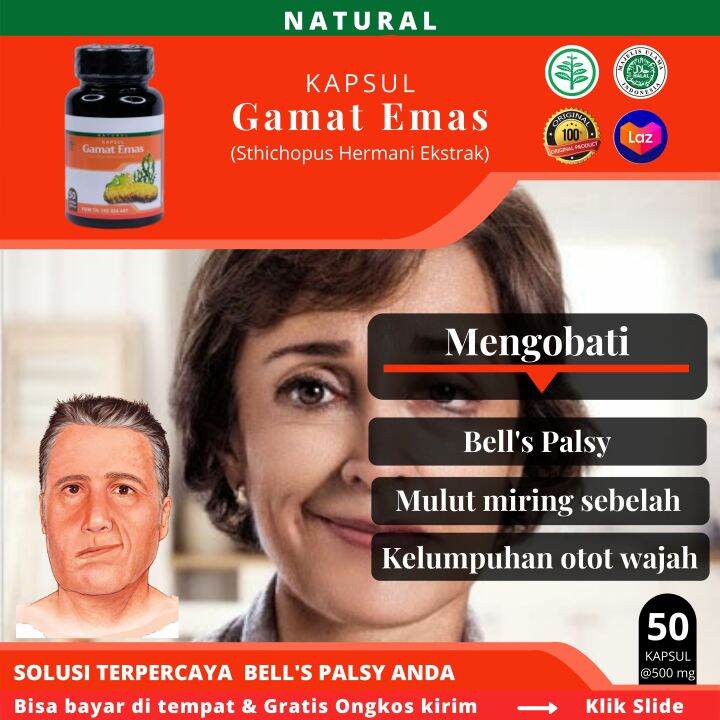 Obat Bells Palsy Mulut Miring Sebelah Bibir Mencong Stroke Ringan Gejala Mata Berair Ngeces