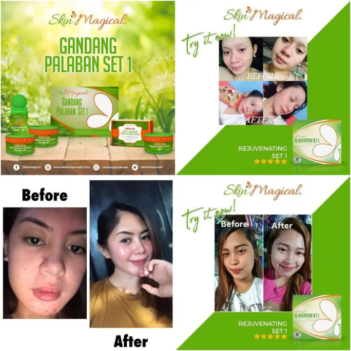 Skin Magical Set 1 | Lazada PH