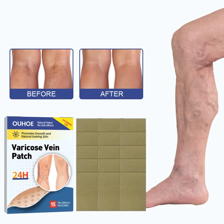 15Pcs/Box Vessel Blockage Patch Fast Absorbing Non-irritating Effective ...