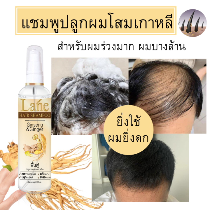 Lane แชมพูปลูกผม ปลดผมร่วง แชมพูเร่งผมยาว แชมพูโสม แชมพูขิง hair growth ...