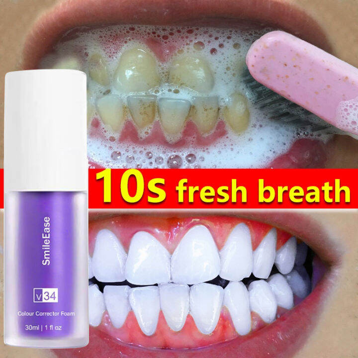 YANJIAYI Smile Ease Toothpaste V34 teeth whitening teeth colour ...