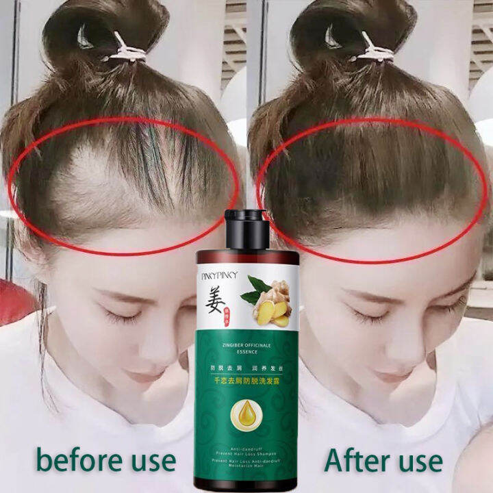 New Powerful Herbal Essences Hair Growth Shampoo Anti Hair Loss Ginger