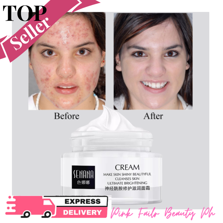 SENANA CREAM Nicotinamide Niacinamide Hyaluronic Acid Lighten Dark ...