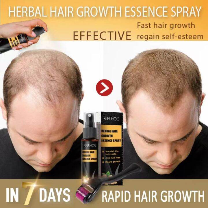 hair grower for men original minoxidil hair growth hair grower for ...