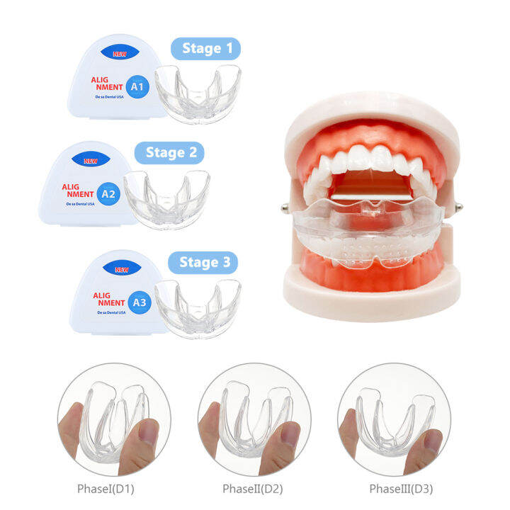 Dental Orthodontic Braces Set 3 Stages Silicone Alignment Trainer Teeth ...