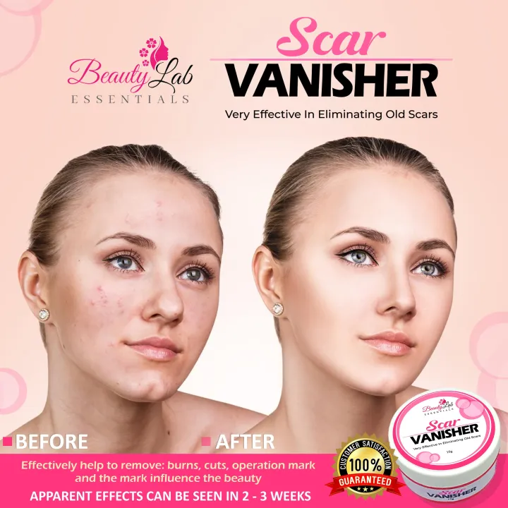 BEAUTY LAB ESSENTIALS SCAR VANISHER 10g for STRETCH MARKS Scar remover ...