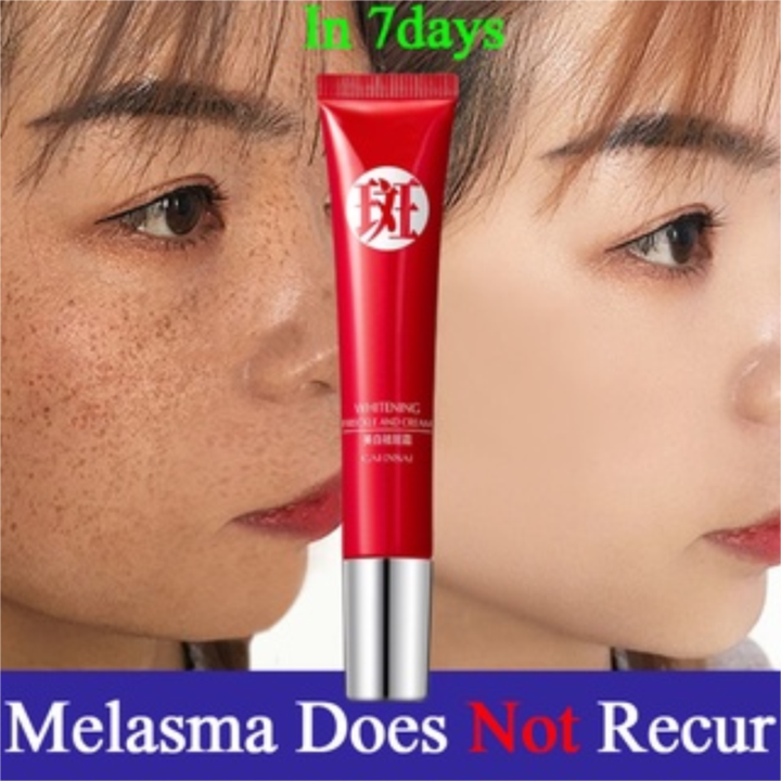 7 Days Powerful Whitening Freckle Cream Remove Melasma and Dark Spots Effective Whitening ...