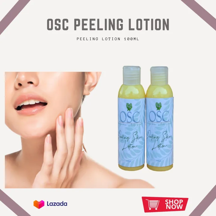 OSC Peeling Lotion Original Skin Renewal Safe And Effective Legit ...