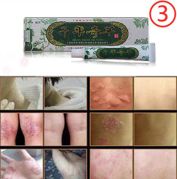 (SET OF 3 ) Millennium Grass Original Ointment Cream 15g | Lazada PH