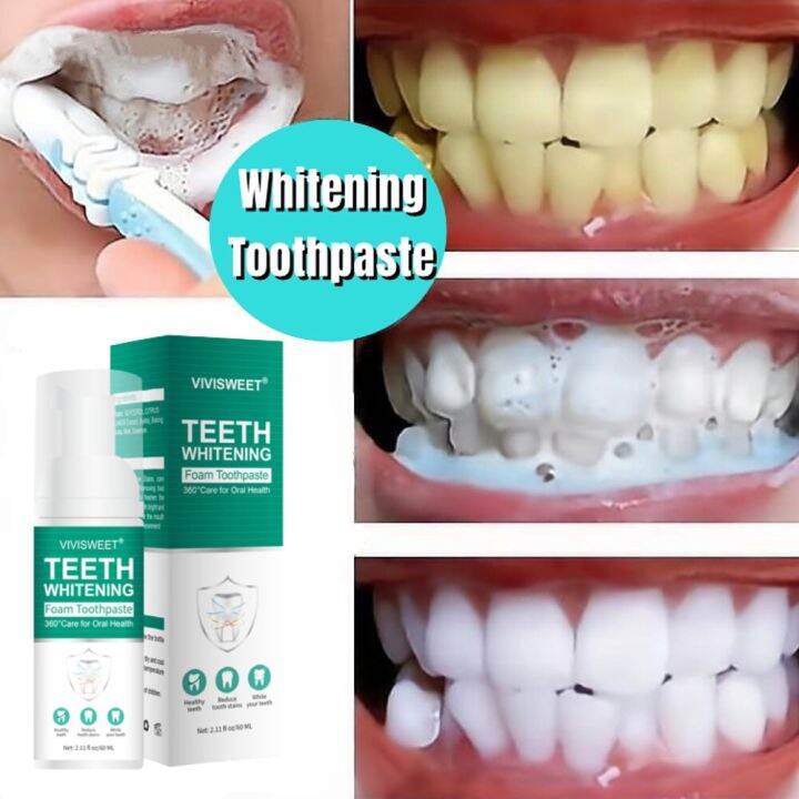 🔥Attraction🔥Tooth Cleaning Mousse Whitening Tooth Mousse Fresh Breath ...