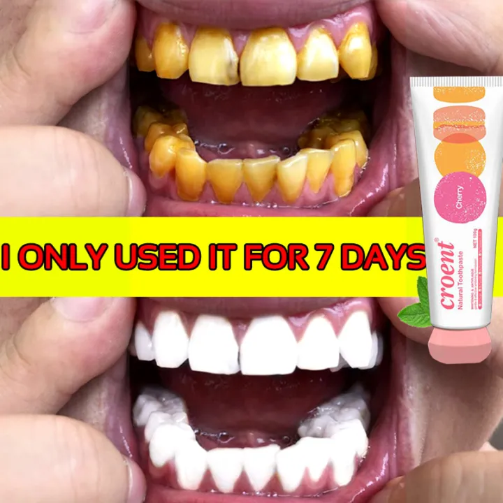 【COD】Macaron Fruit Toothpaste 100g teeth whitening Toothpaste to remove ...