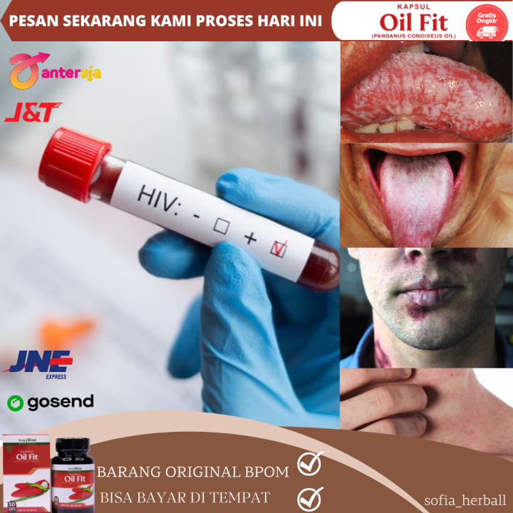 Obat Pria HIV Obat Pencegah HIV AIDS Pria Wanita Memperlambat Infeksi ...