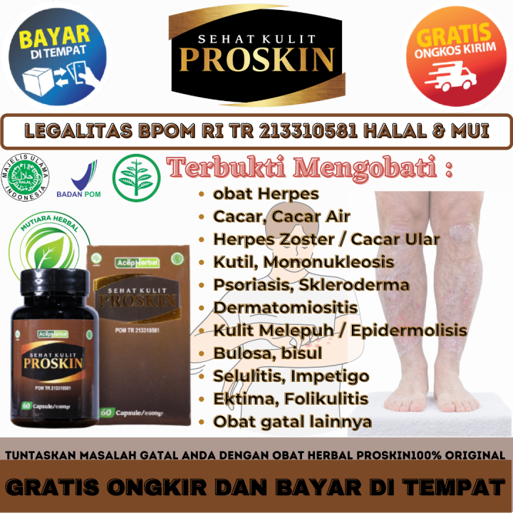 Kapsul Ektrak Daun Binahong obat Herpes, Cacar, Cacar Air, Herpes ...
