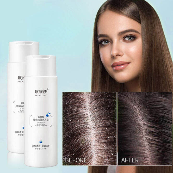 250ml Amino acid Shampoo Anti Dandruff Shampoo deeply clean the scalp ...