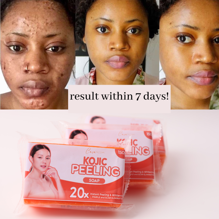 100% LEGIT NA SABON PAMPAPUTI PAMPAKINIS PWEDE SA BUONG KATAWAN IN JUST 7DAYS!! KAHIT 30YRS ...