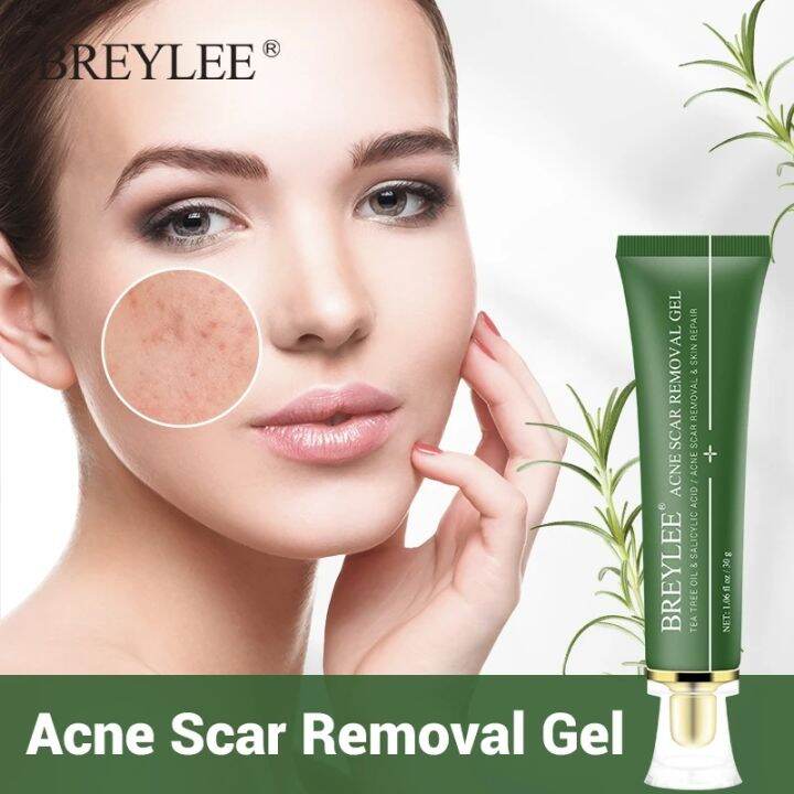 BREYLEE Acne Scar Removal Gel Fade Acne Marks Spots Remove Skin Pigmentation Soothing Prevent ...